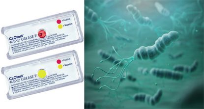 Clo Test Dương Tính, Âm Tính Là Gì? Cách Đọc Hiểu Xét Nghiệm HP