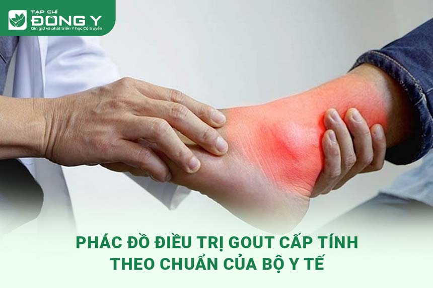 Gout cấp tính: Nguyên nhân, triệu chứng và cách điều trị hiệu quả